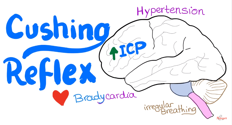 Cushing's Triad - Not A Good Trifecta – Pass with PASS, LLC