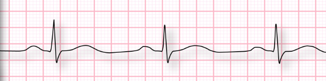 BRASH Syndrome: Bad Synergy – Pass with PASS, LLC