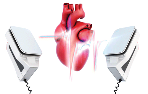 Dual Sequential Defibrillation: Wasted Energy? – Pass with PASS, LLC